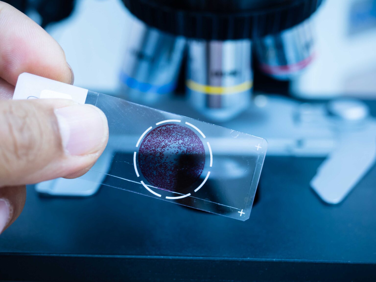 Pathology — Fall Hill Gastroenterology Associates In FXBG